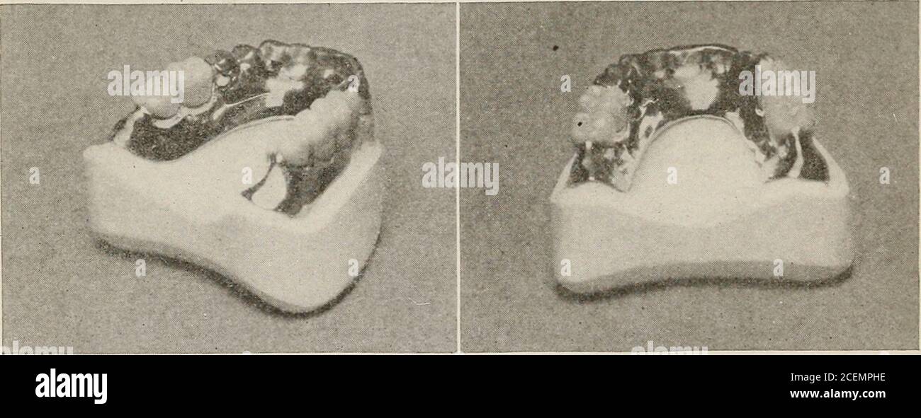 Plaster cast models hi-res stock photography and images - Alamy