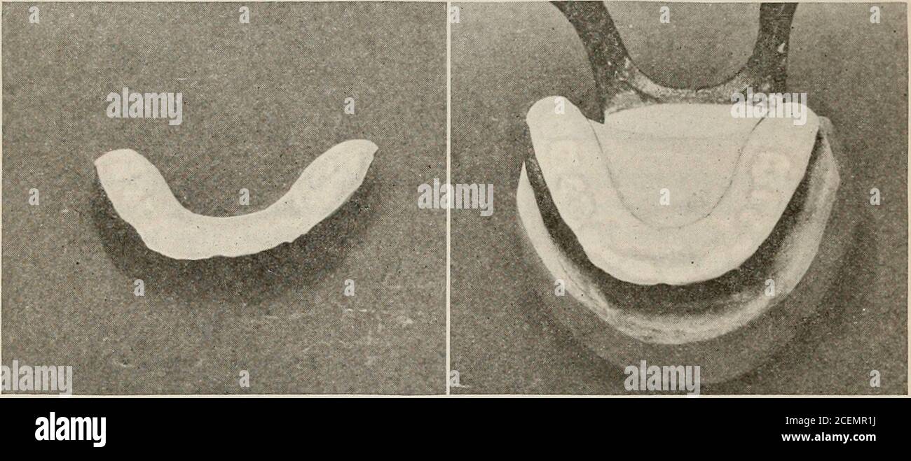 . Proceedings of the North Carolina Dental Society [serial]. 2.; After ...
