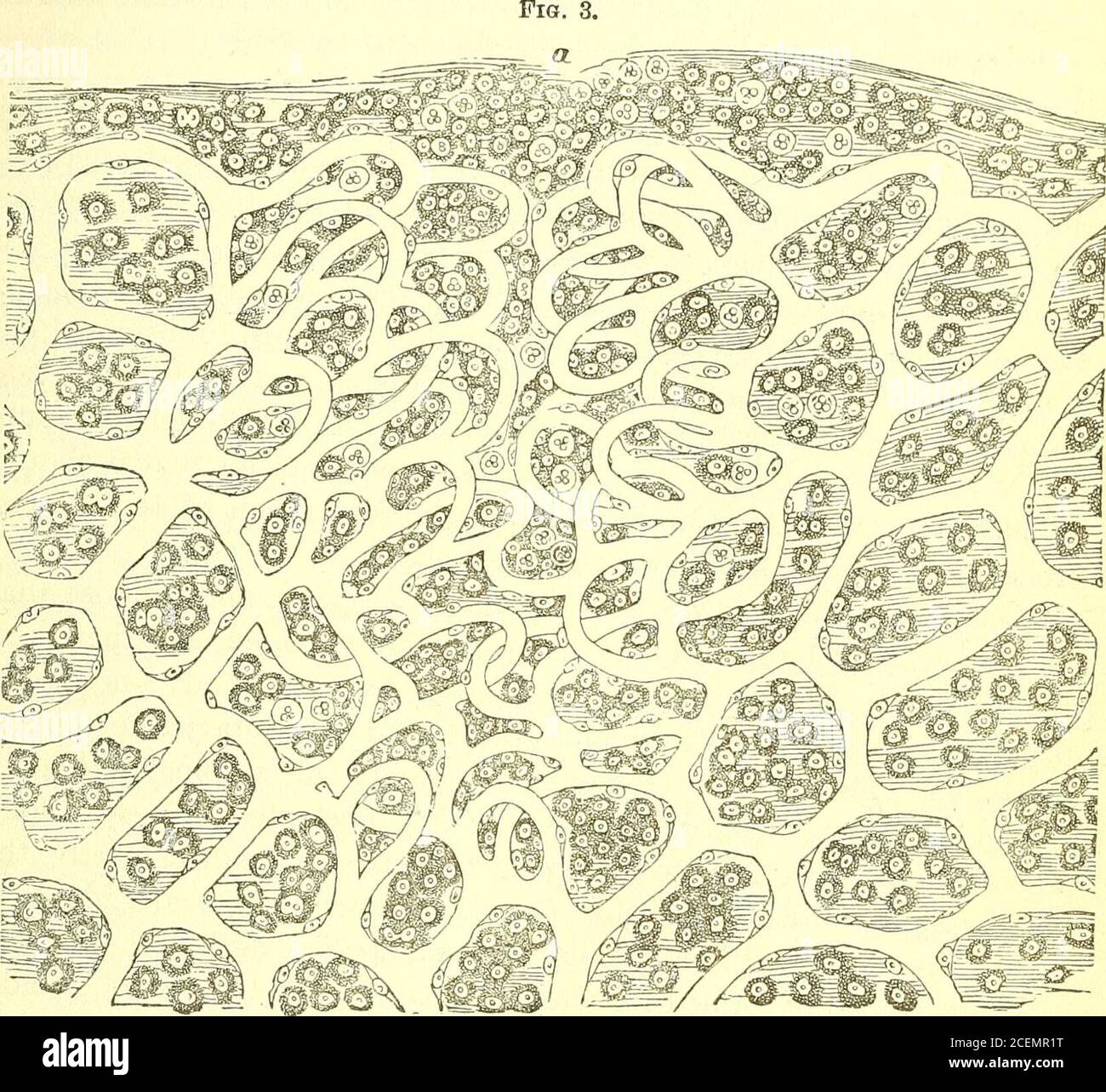 Surgical wound swelling hi-res stock photography and images - Alamy