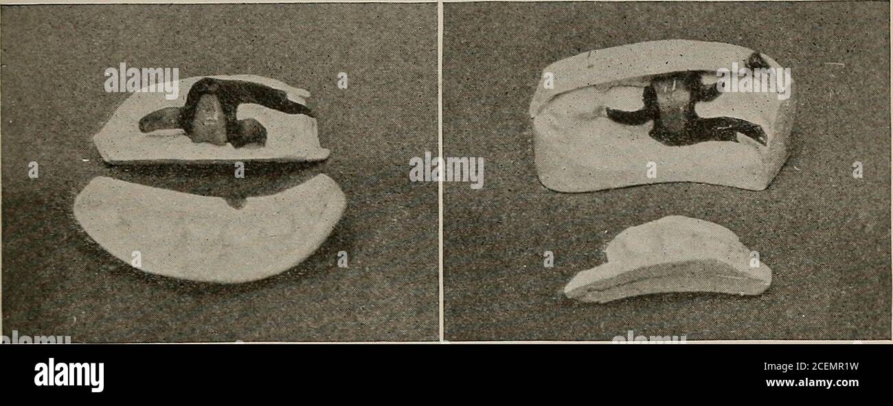 . Proceedings of the North Carolina Dental Society [serial]. llowed to ...