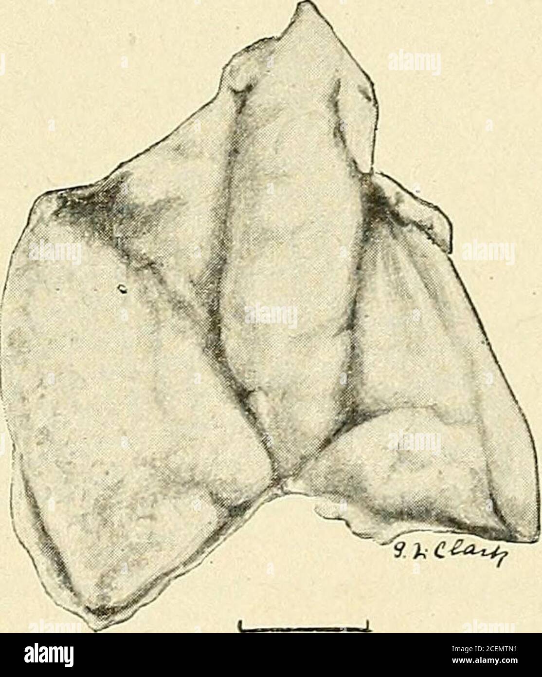 . Diseases of children. / c «; Fig. 44. Fig. 45 Fig. 44.—Conglomerate ...