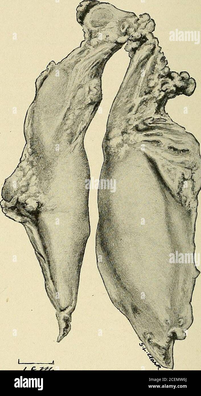 Thymic hi-res stock photography and images - Alamy