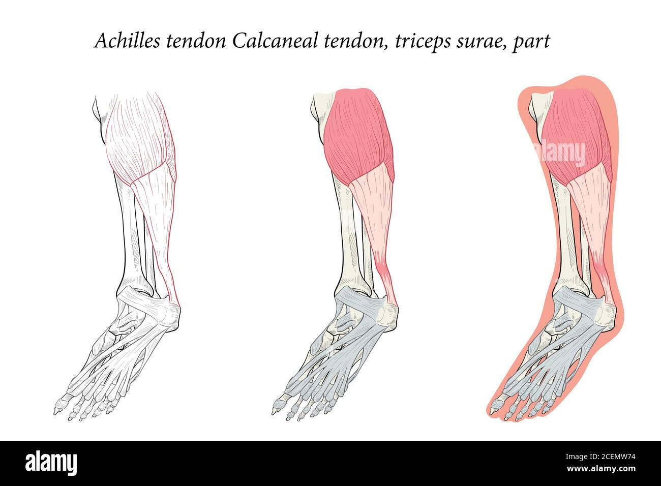 Medical illustration oblique bottom view of Foot Achilles tendon ...