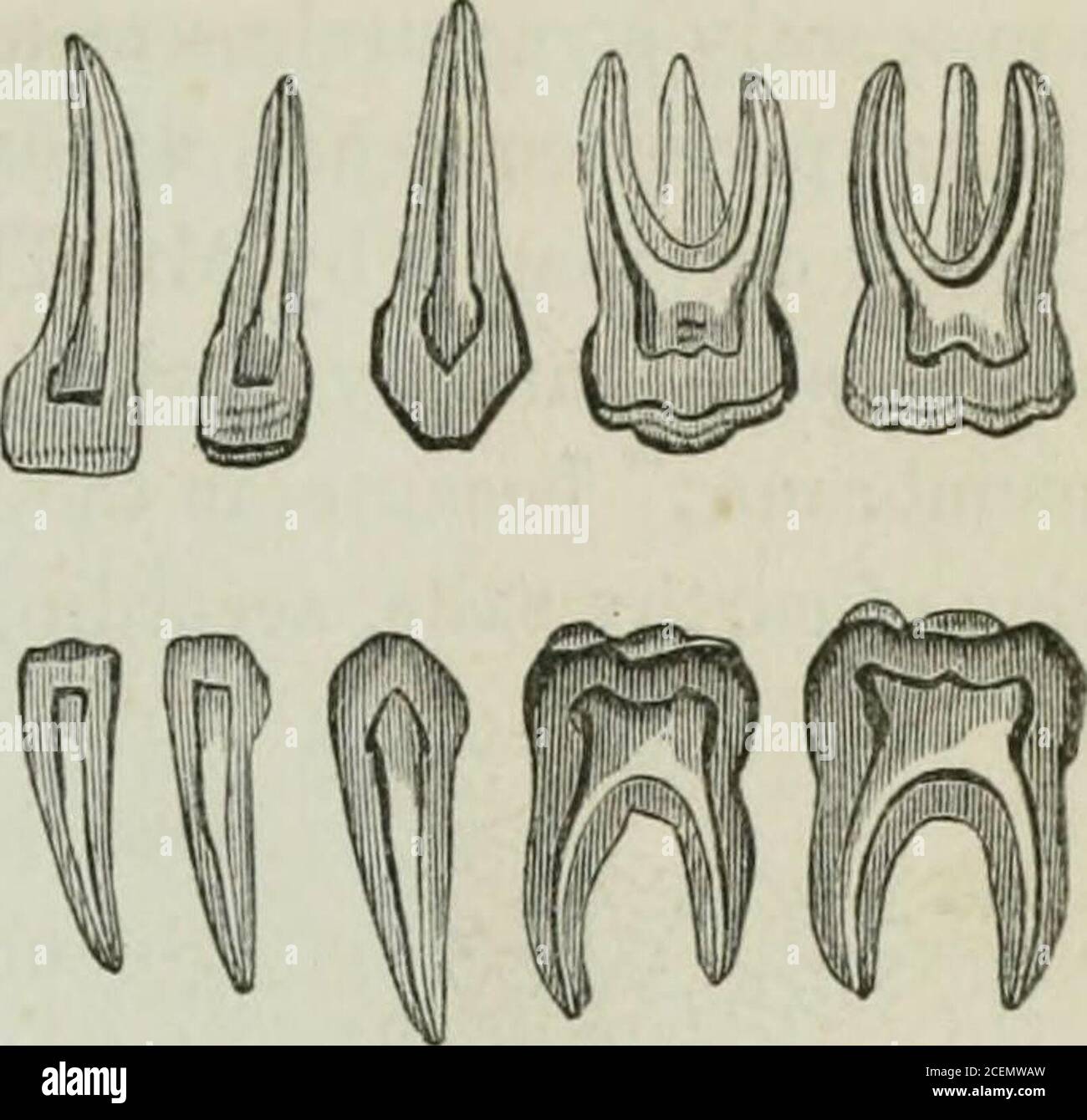 Pulp Cavity