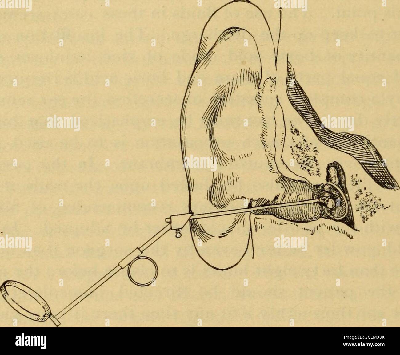 Exuberant granulation hi-res stock photography and images - Alamy