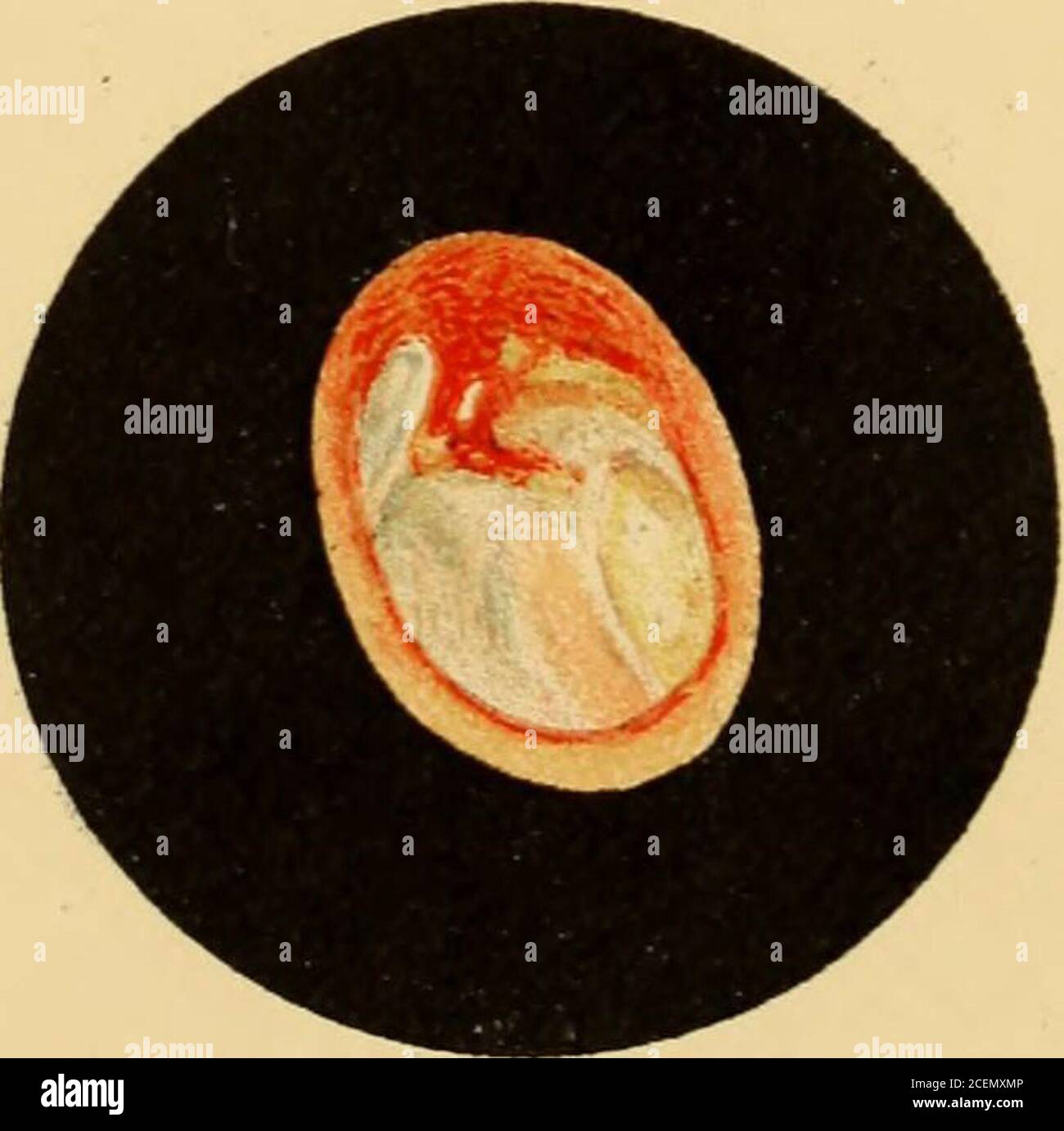 Otoscopic hi-res stock photography and images - Alamy