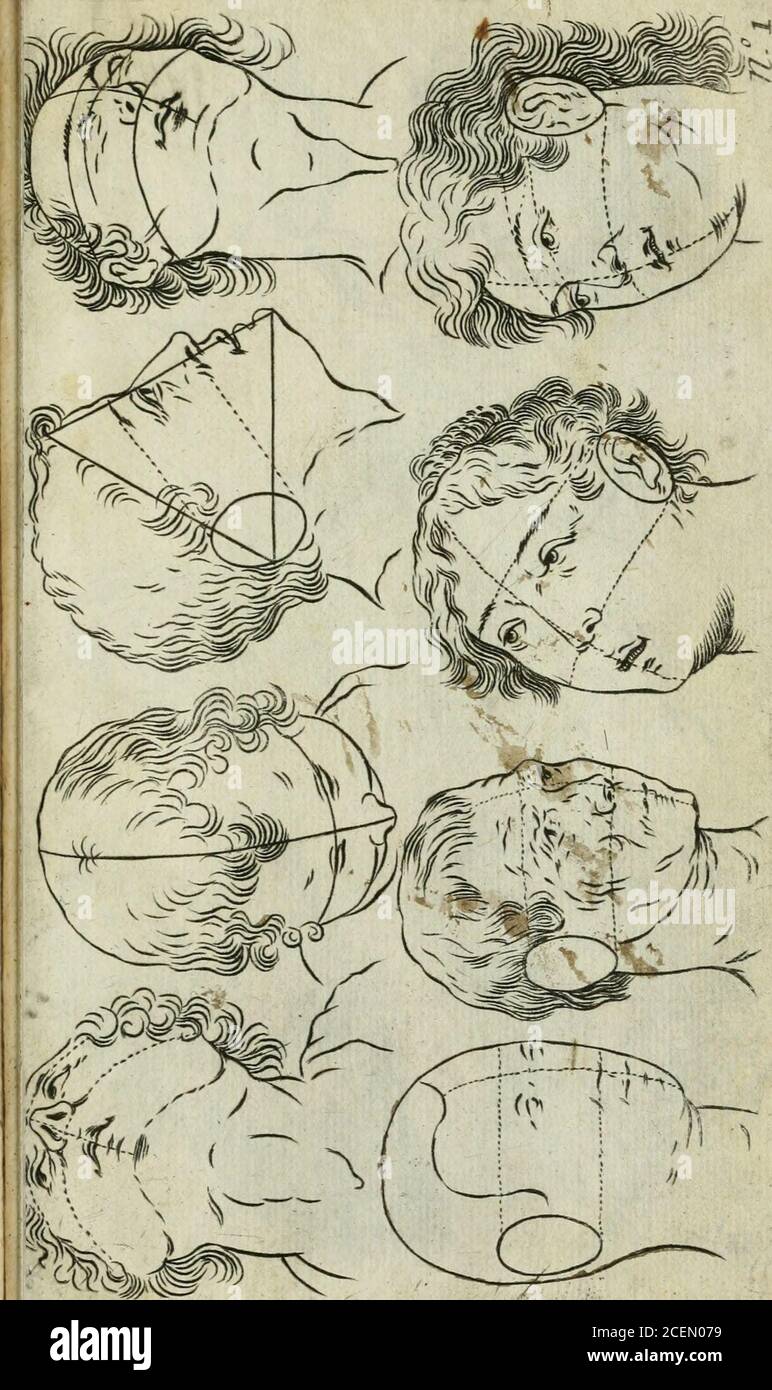 Rickets head hi-res stock photography and images - Alamy