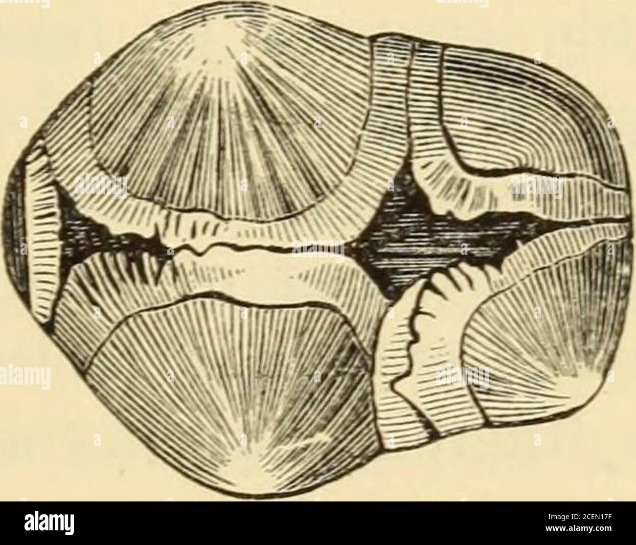 Ossification of diploe hi-res stock photography and images - Alamy