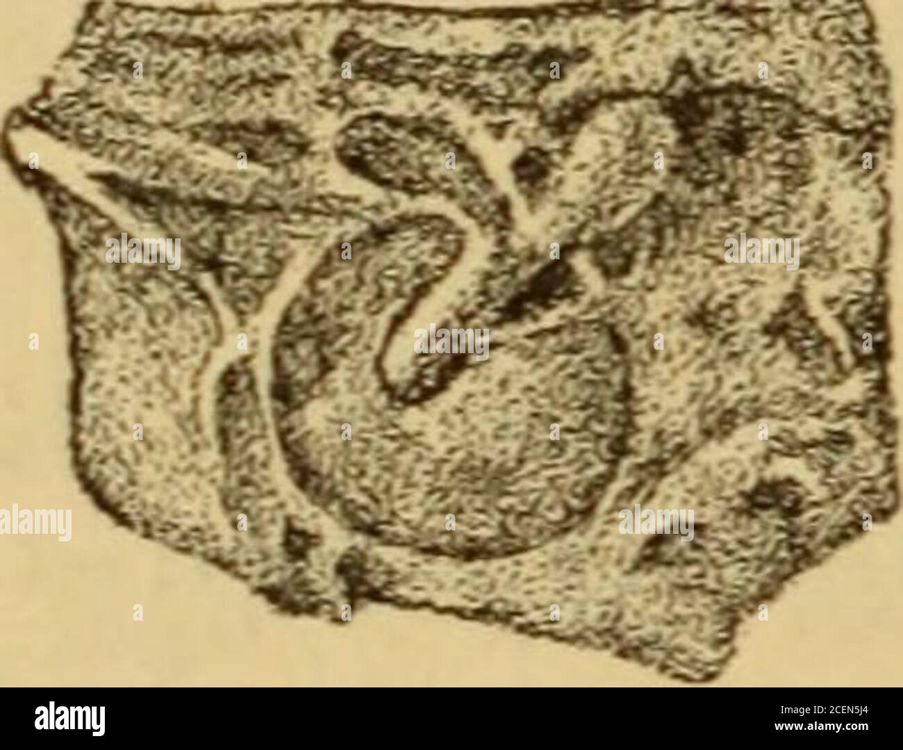 Tonsil membrane hi-res stock photography and images - Alamy