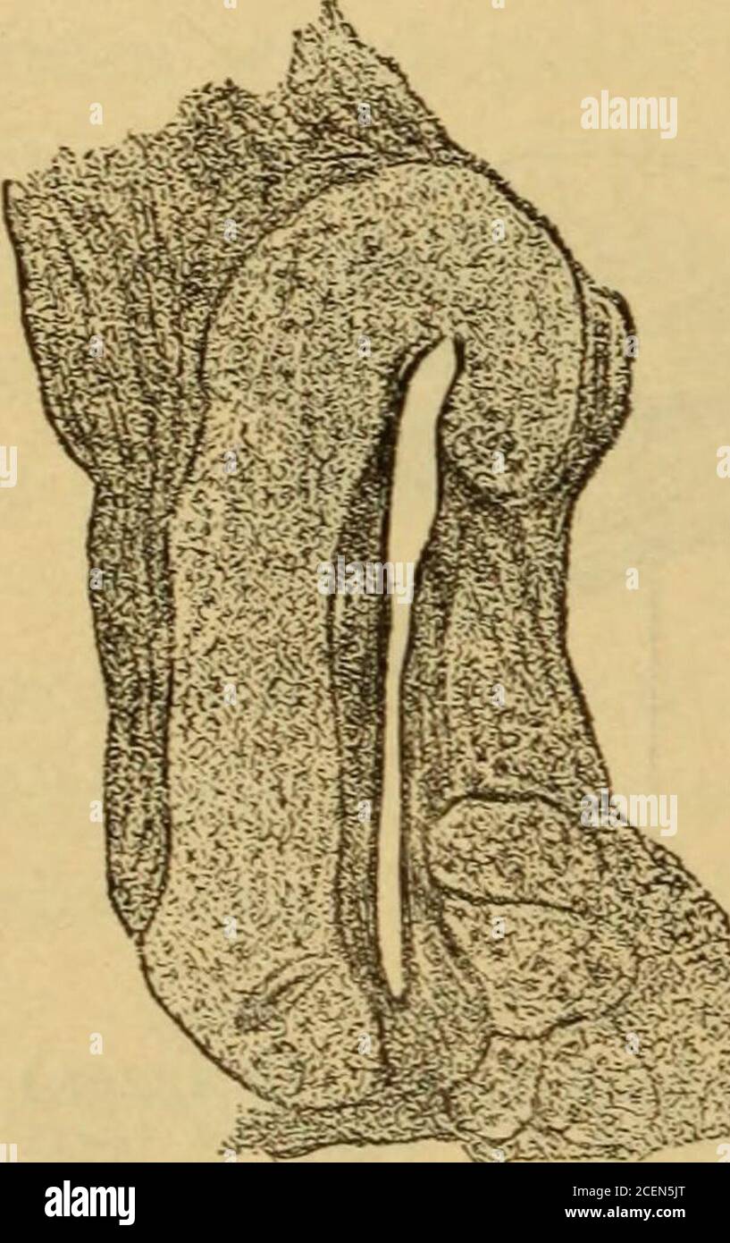 Border orifice hi-res stock photography and images - Alamy