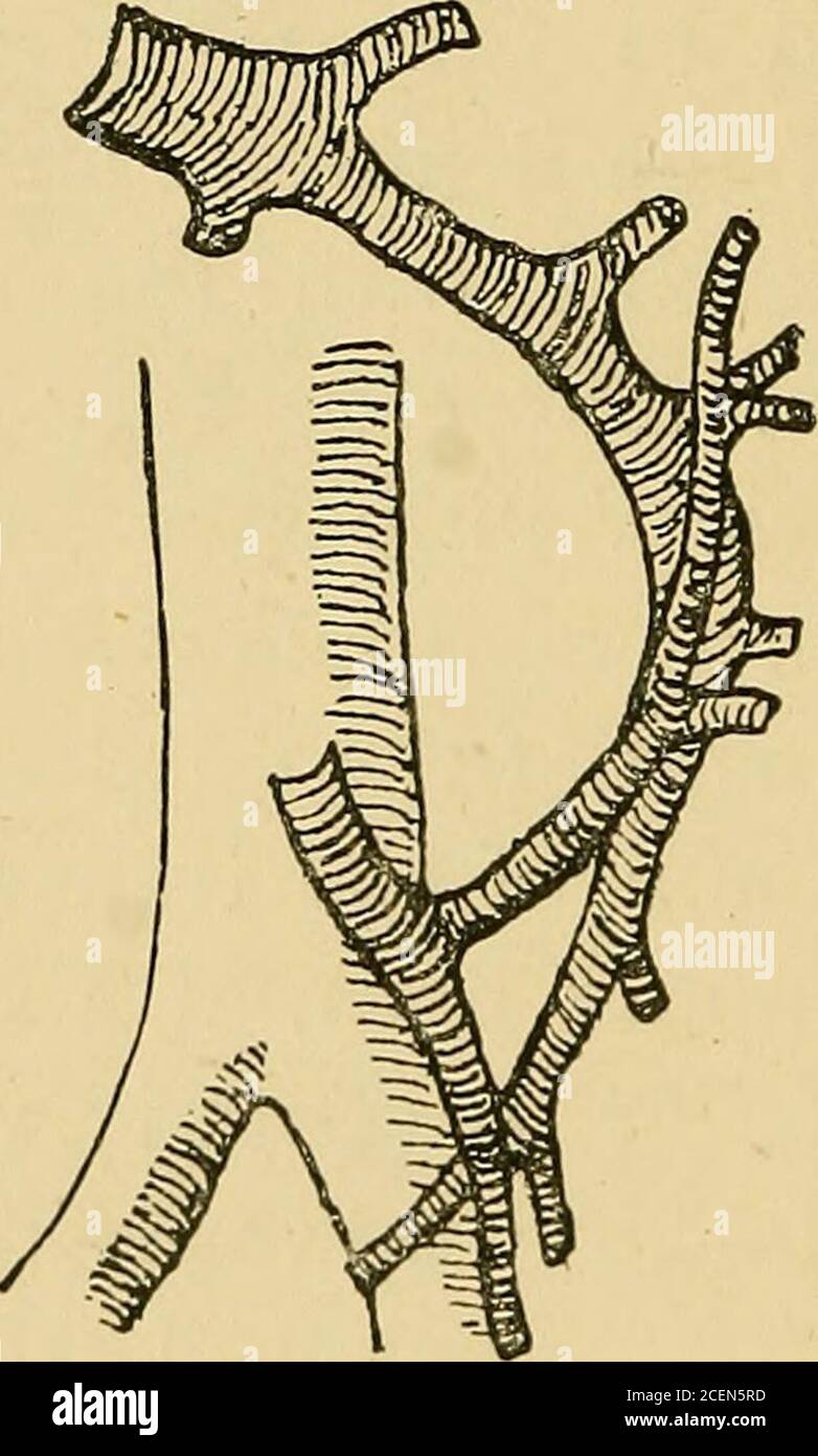 . On retro-peritoneal hernia : being the 'Arris and Gale' lectures on ...