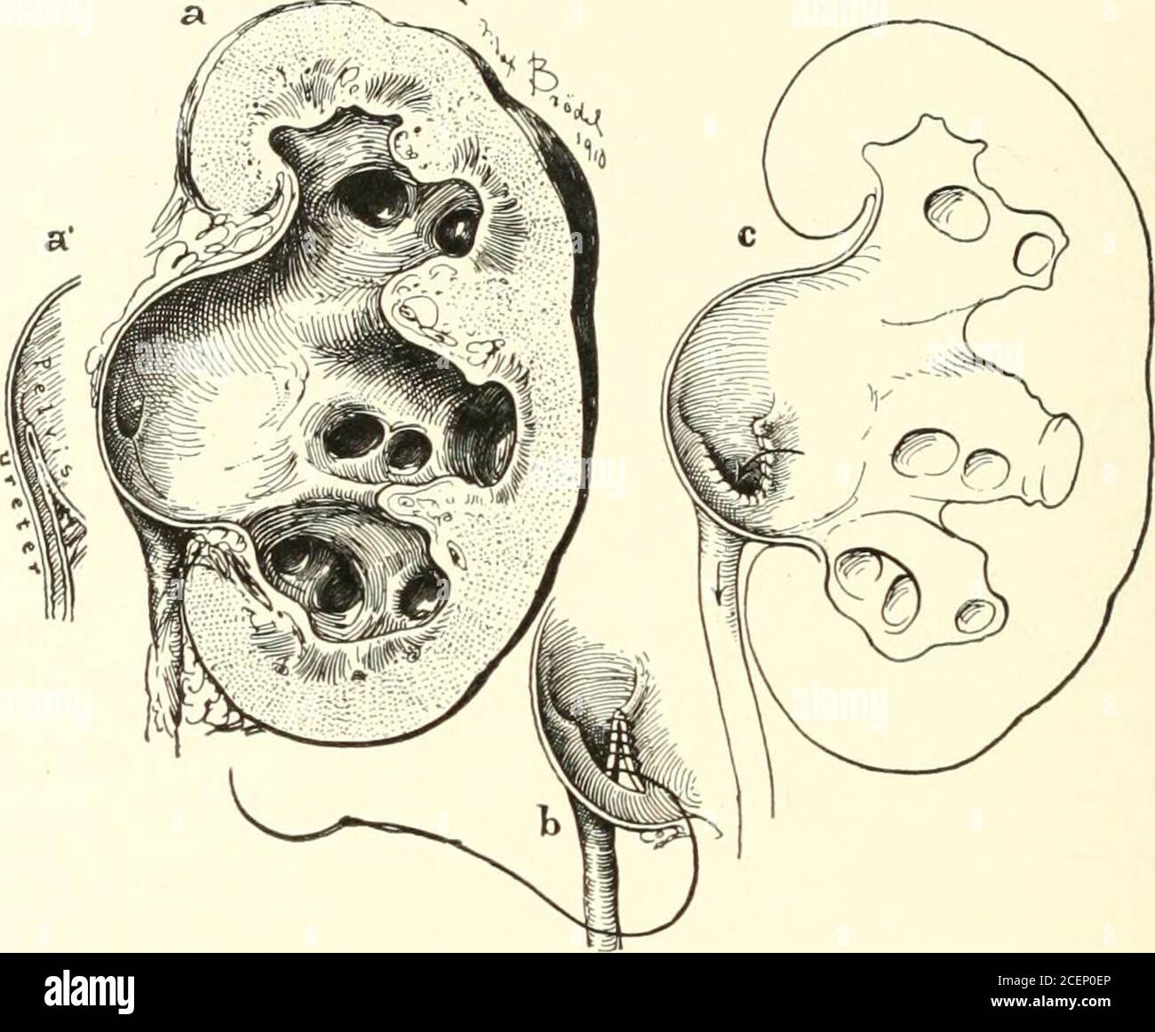 . Diseases of the kidneys, ureters and bladder, with special reference ...