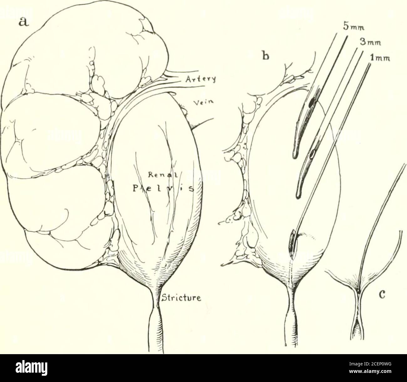 . Diseases of the kidneys, ureters and bladder, with special reference ...