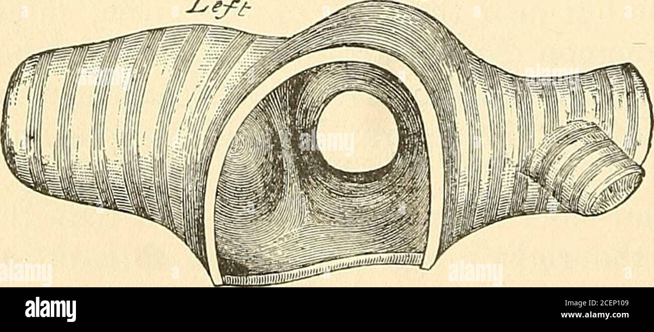 Carina Trachea Bifurcation