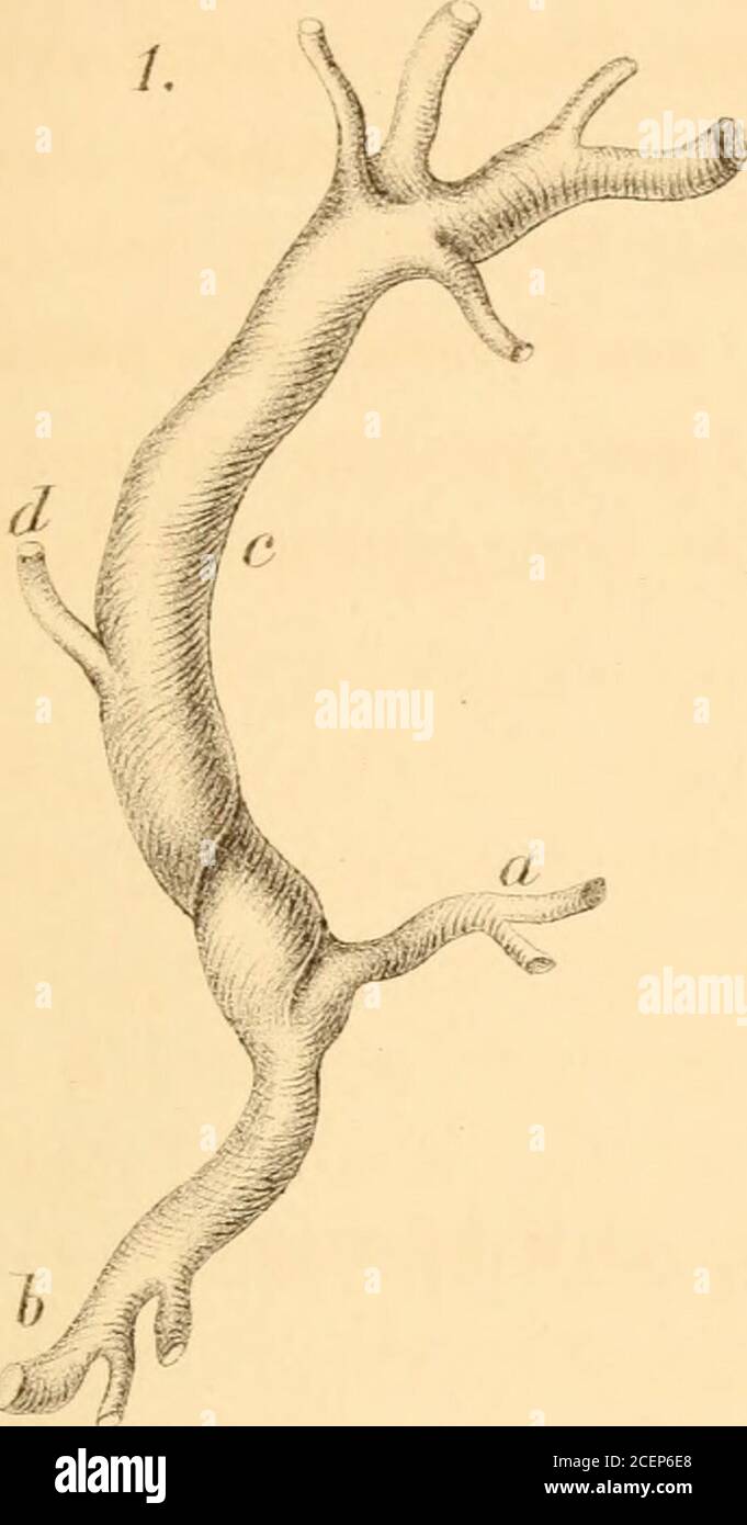 A lienalis hi-res stock photography and images - Alamy