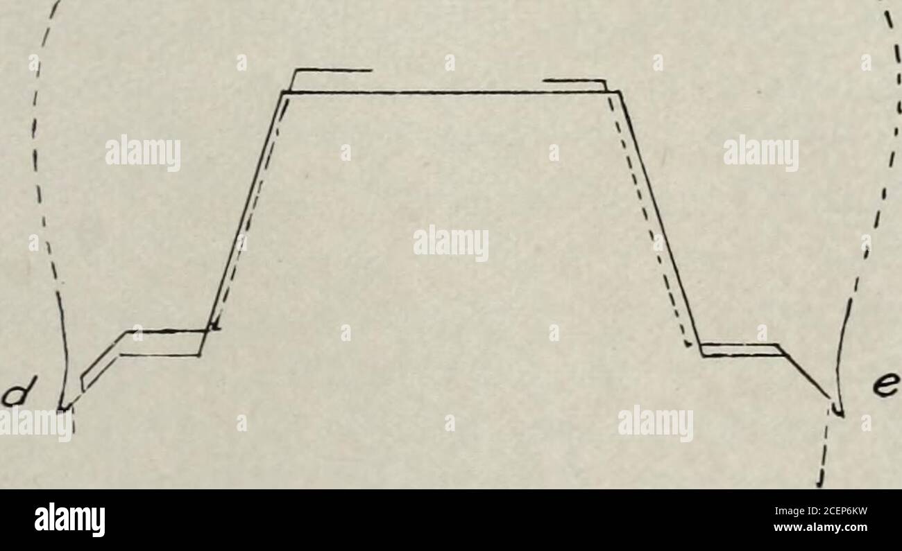 . The Dental cosmos. i occluso-distal inlay for a molar (Fig. 1)and ...
