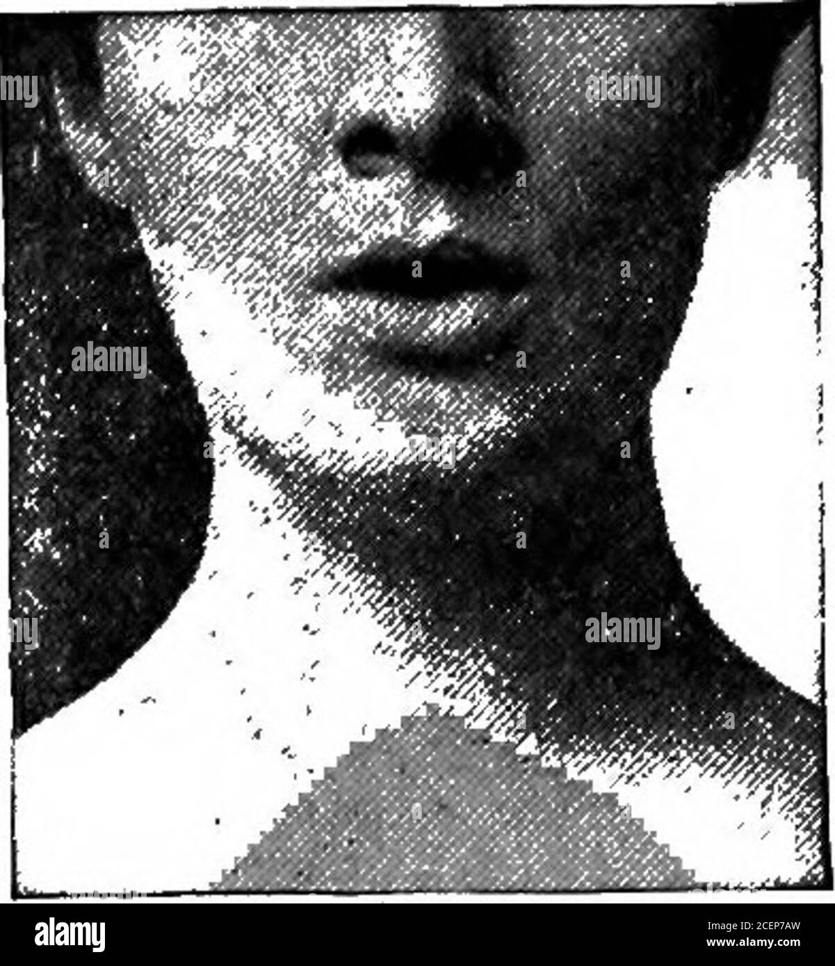 . Resonance in singing and speaking. Figure 2. Figure 3 Stock Photo - Alamy