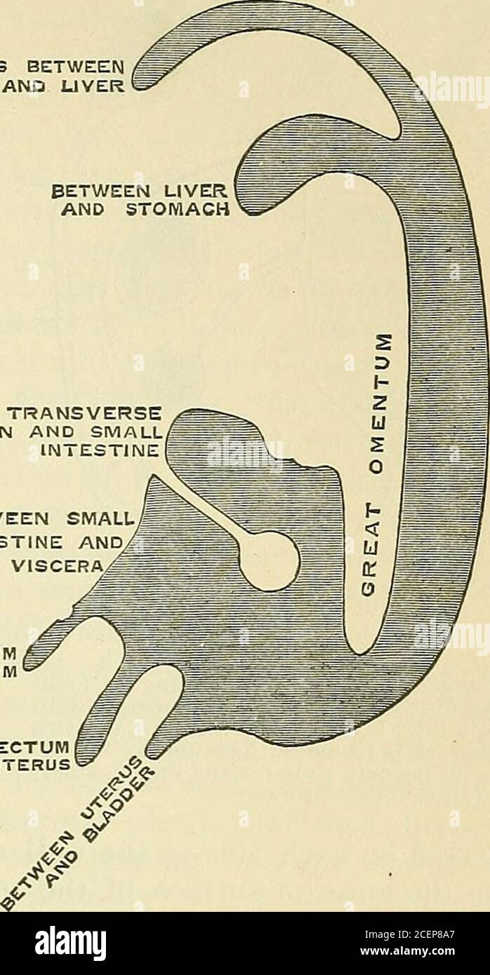 Peritoneum cavity hi-res stock photography and images - Alamy