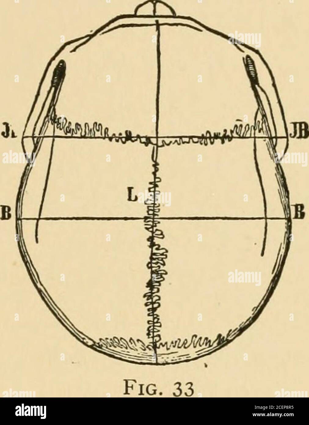 . Criminal man, according to the classification of Cesare Lombroso. Fig ...