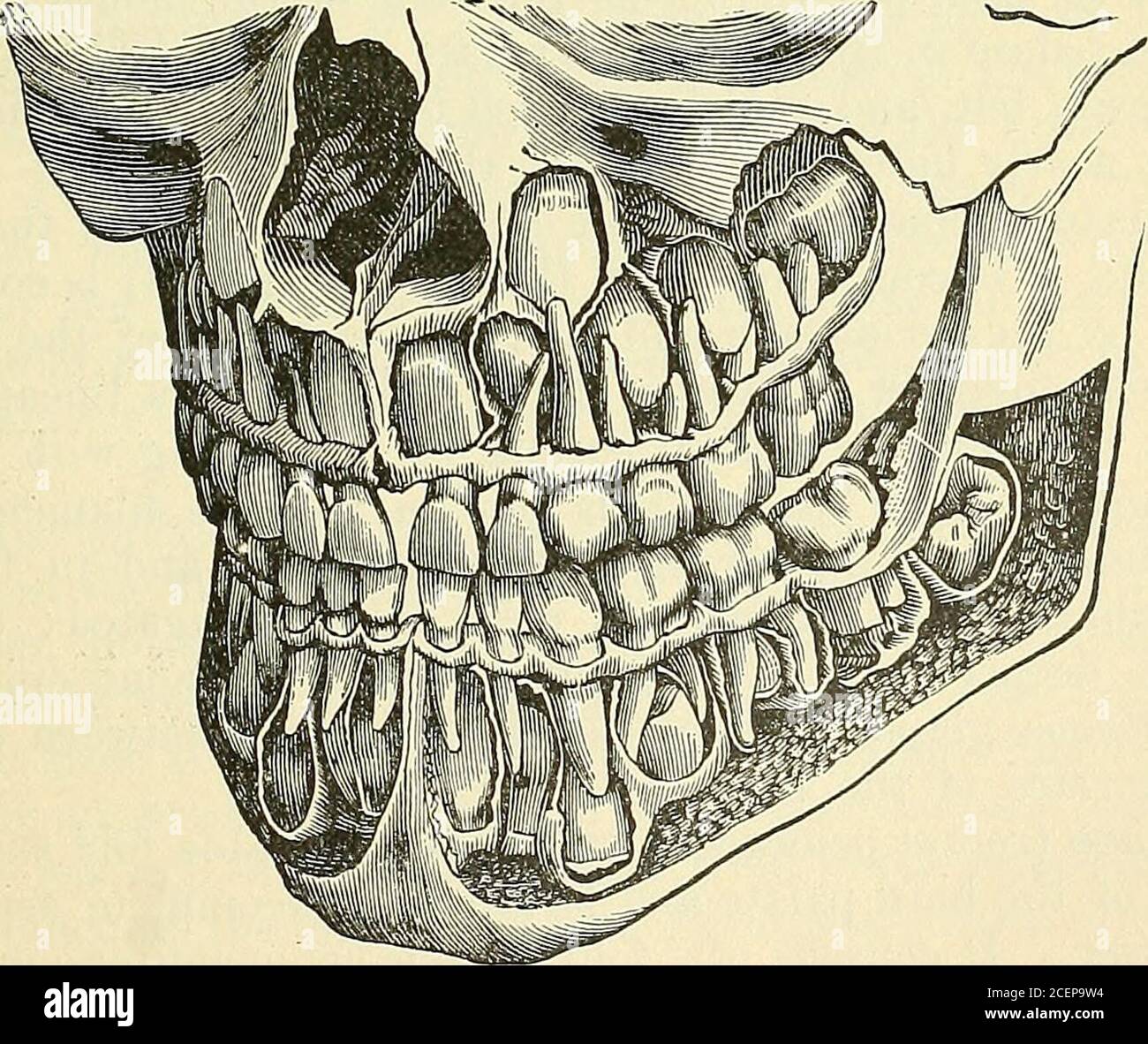 . Anatomy, descriptive and surgical. tely preceding tooth. During the ...