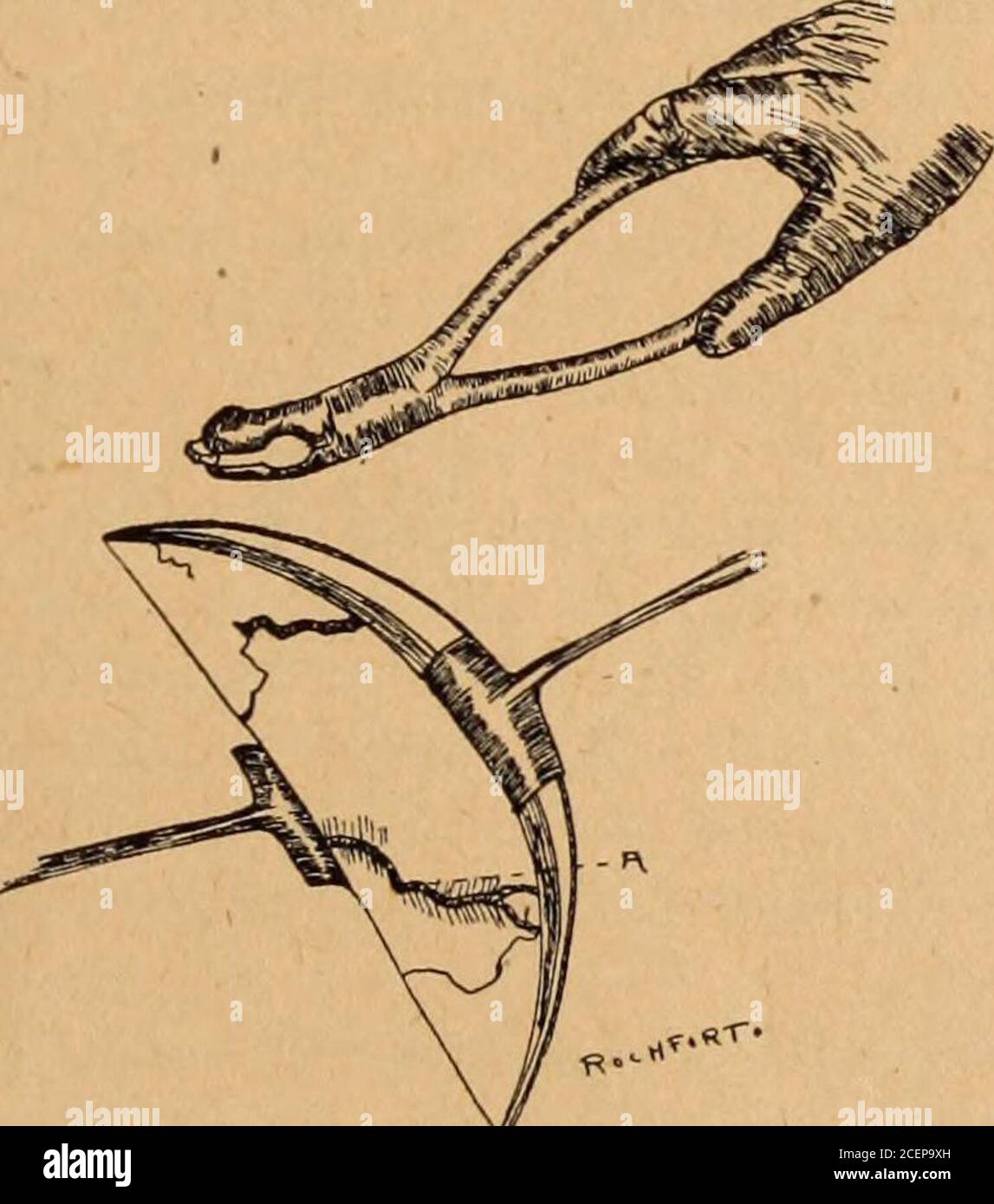 . Virginia medical semi-monthly. ne. A sharp periosteal elevatoris used ...