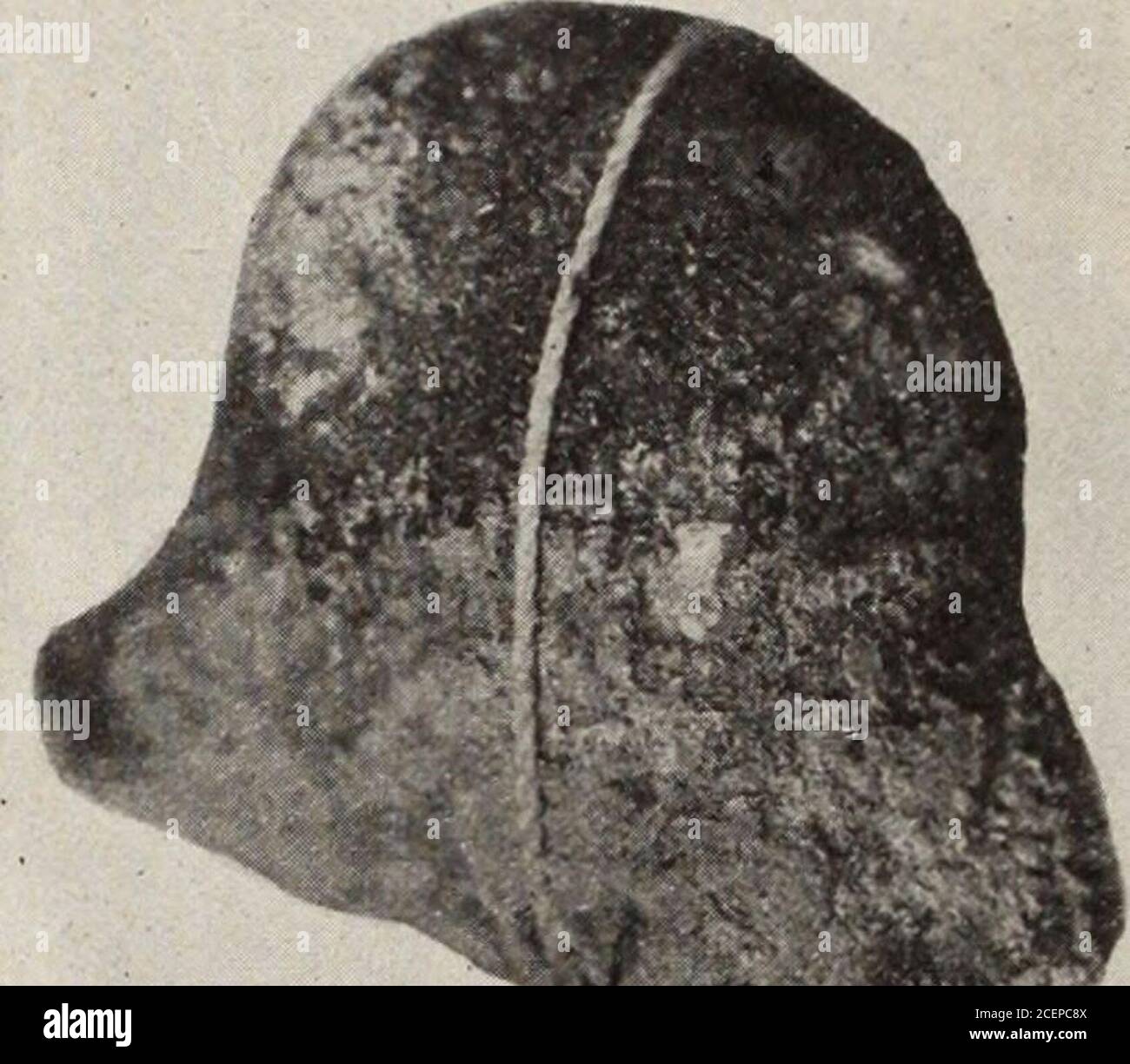 . Virginia medical semi-monthly. whole kidney wasone multilocular ...