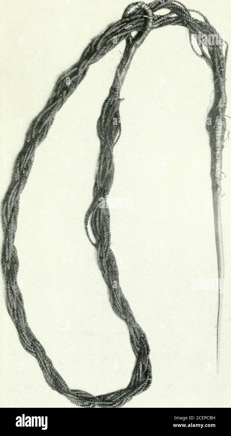 Strangling cord hi-res stock photography and images - Alamy