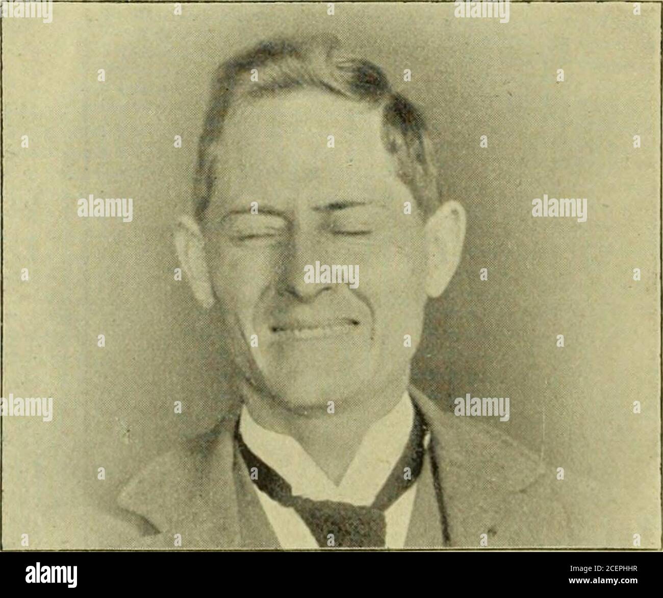 Neurolo hi-res stock photography and images - Alamy