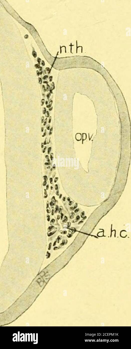 Section through brain frontal section hi-res stock photography and ...