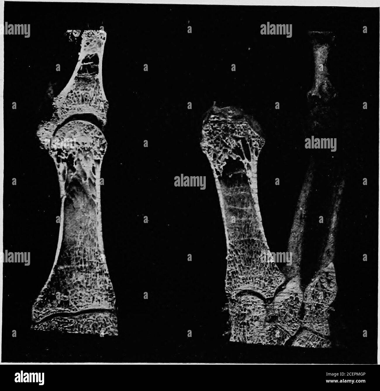 . On boneformation, its relation to tension and pressure;. eristic of ...