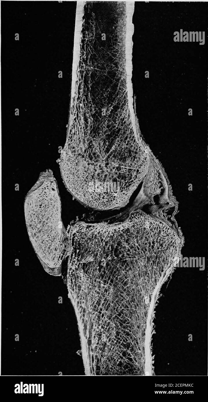 . On boneformation, its relation to tension and pressure;. b Fig. 44 ...