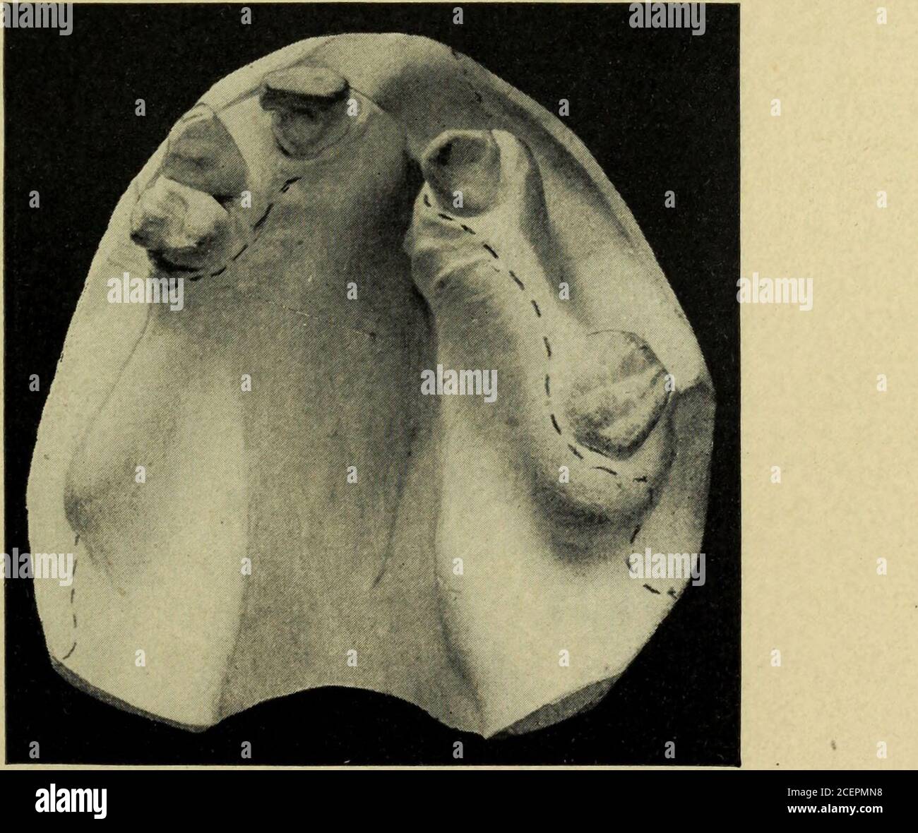 Cleft Tongue High Resolution Stock Photography and Images - Alamy