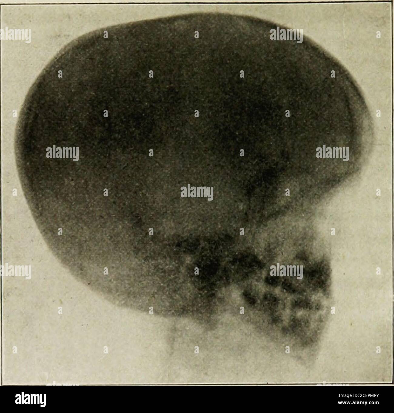 . The diseases of infancy and childhood. chondrodystrophy are unknown ...