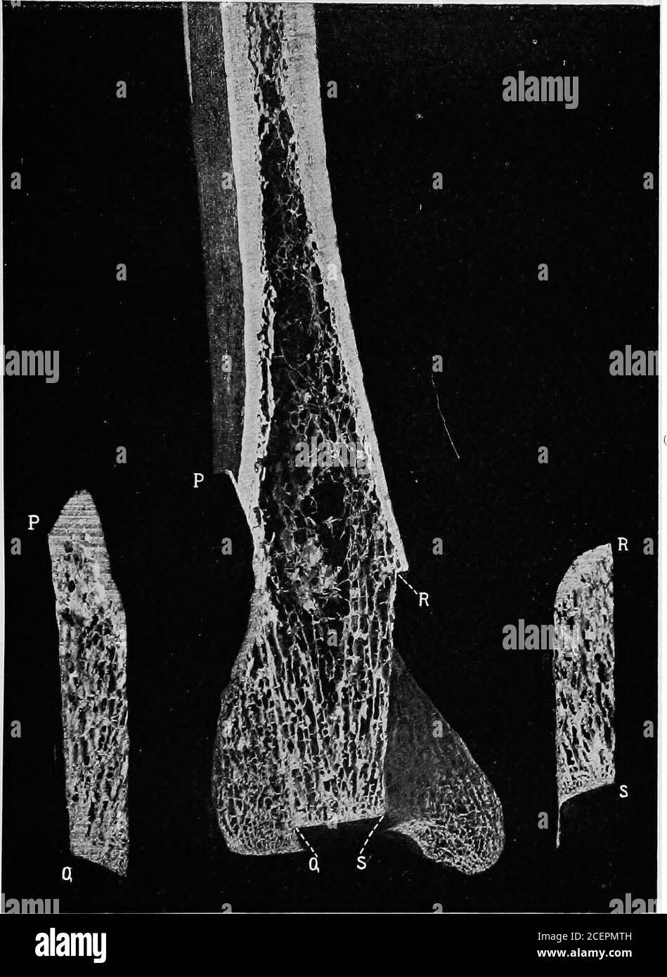 Trabeculae Black and White Stock Photos & Images - Alamy