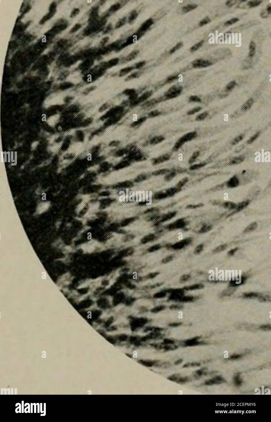 . Radium, X rays and the living cell. n vitro cultures ofmalignant ...