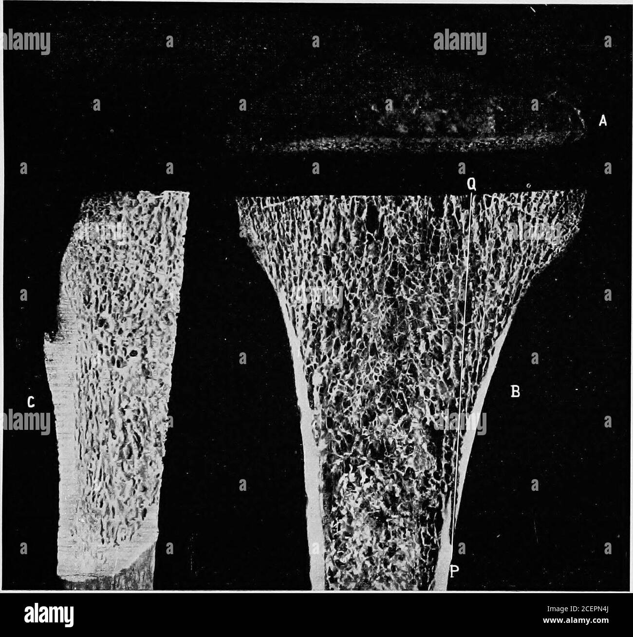 . On boneformation, its relation to tension and pressure;. Eig. 41. Fig ...