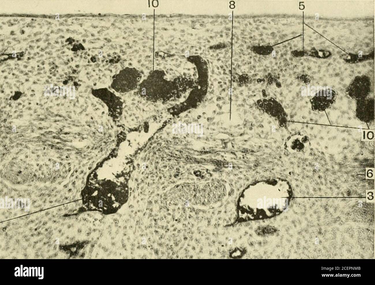 . The American journal of anatomy. 13). Finally, in the13.5, 14.5 and ...