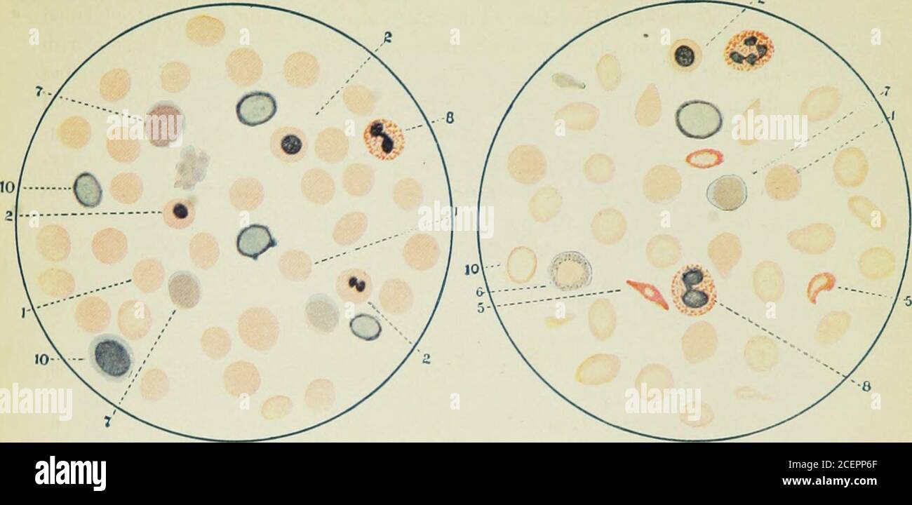 Myelocytes hi-res stock photography and images - Alamy