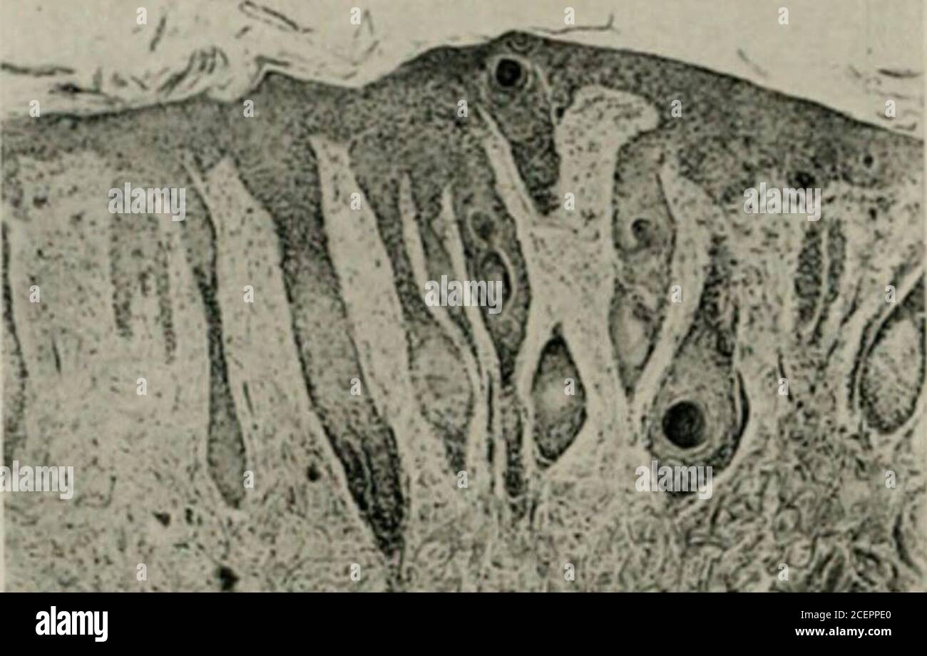 Cellular debris hi-res stock photography and images - Alamy