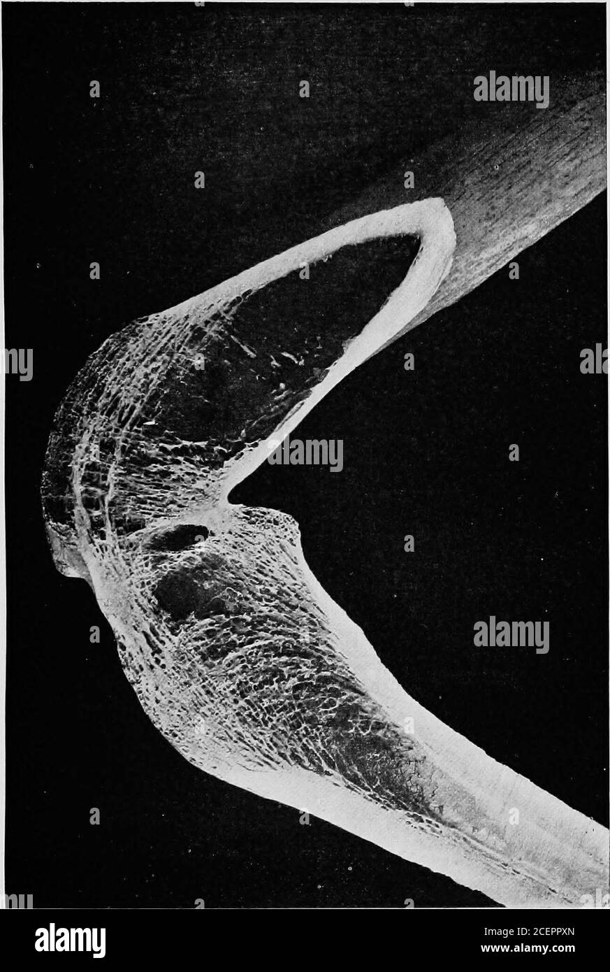 . On boneformation, its relation to tension and pressure;. Fig. T9. Fig ...