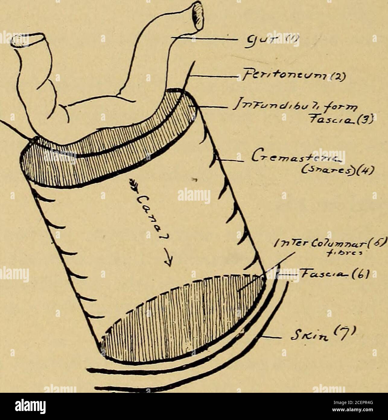 . Surgical differentials. bsorbable sutures andthe second is ...