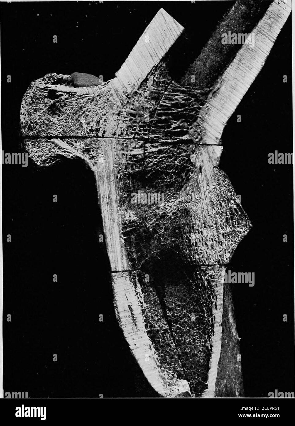 . On boneformation, its relation to tension and pressure;. big. i;. Fig ...