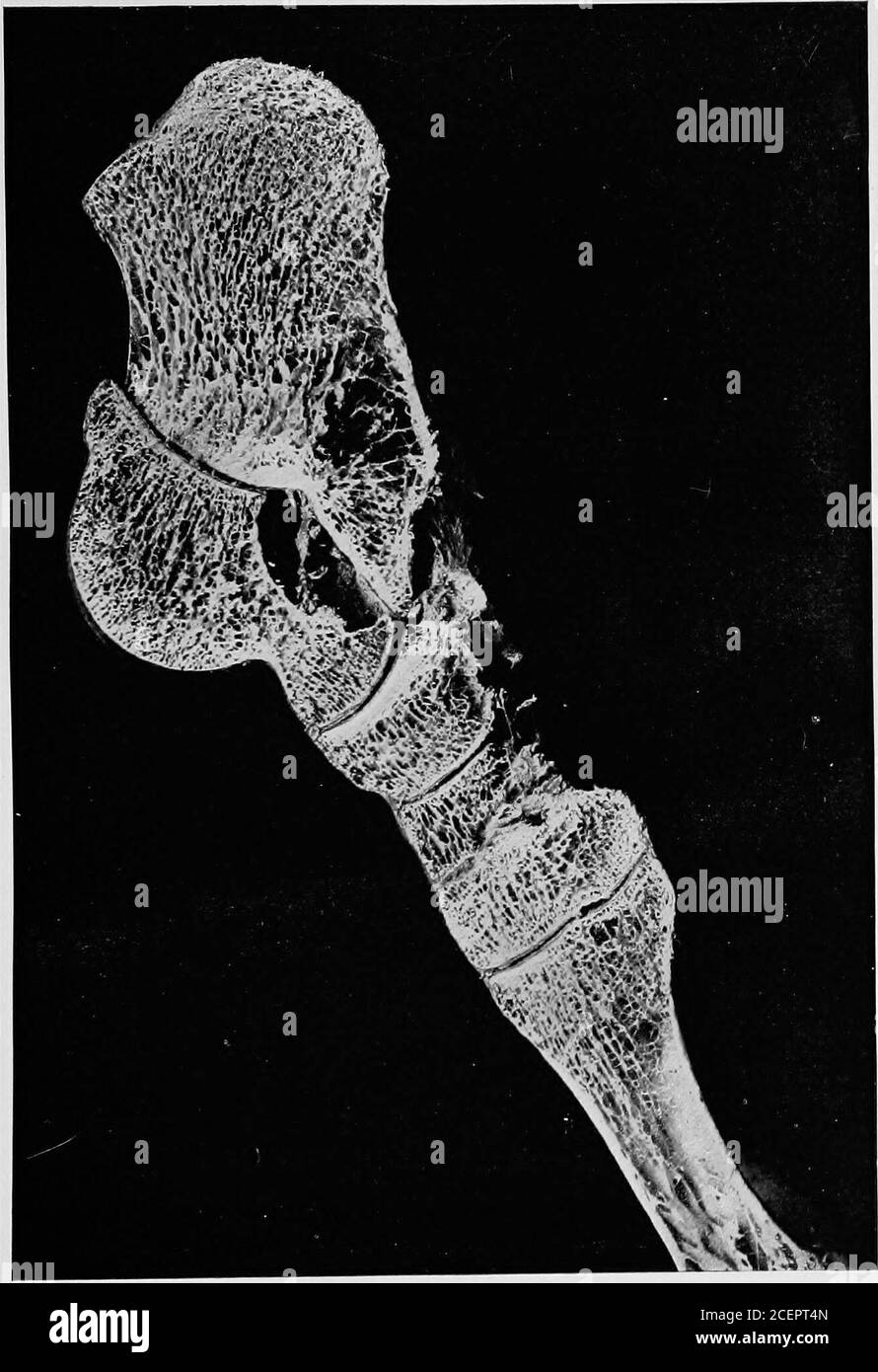 . On boneformation, its relation to tension and pressure;. 00 Stock ...
