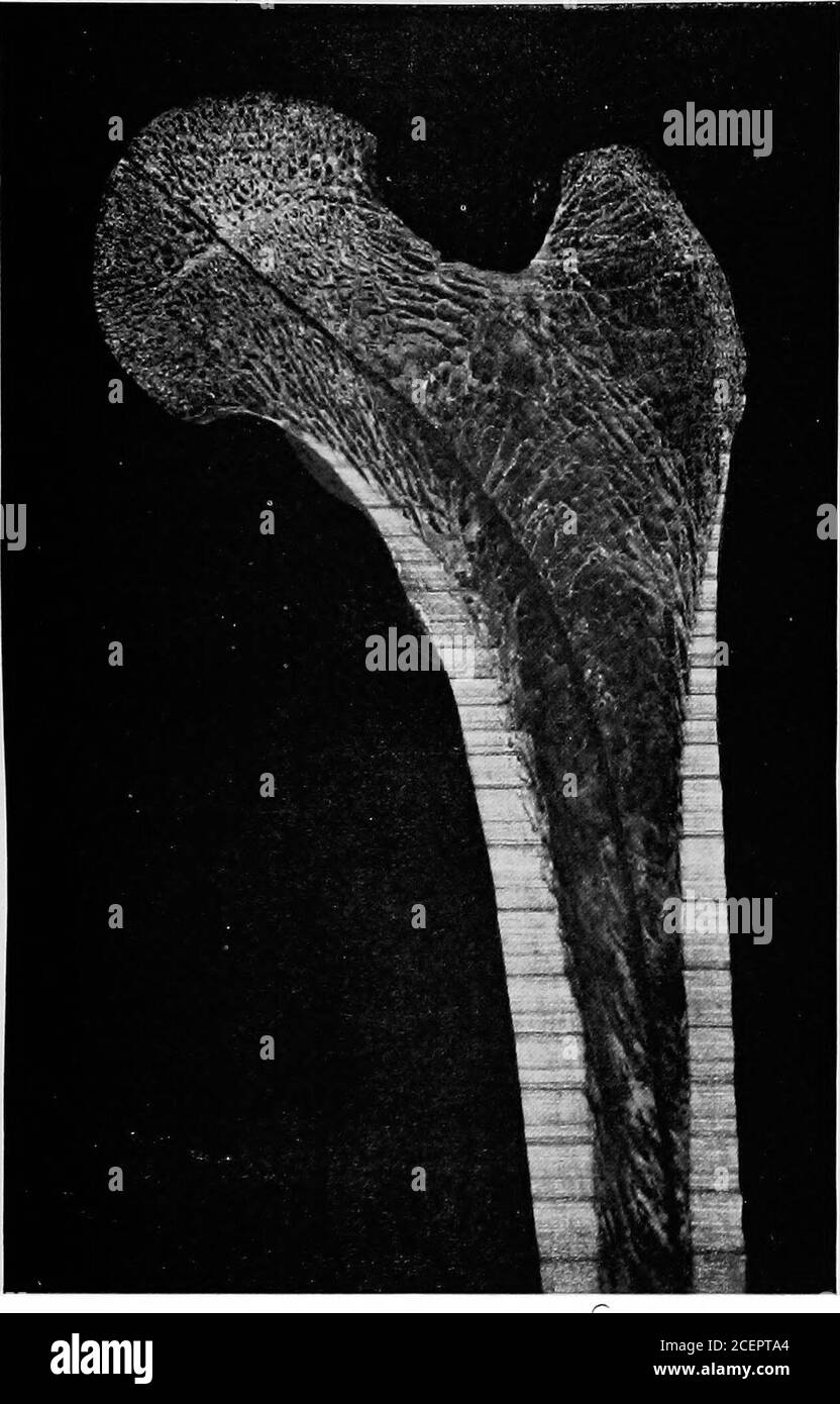 . On boneformation, its relation to tension and pressure;. Fig. 4. Fie ...