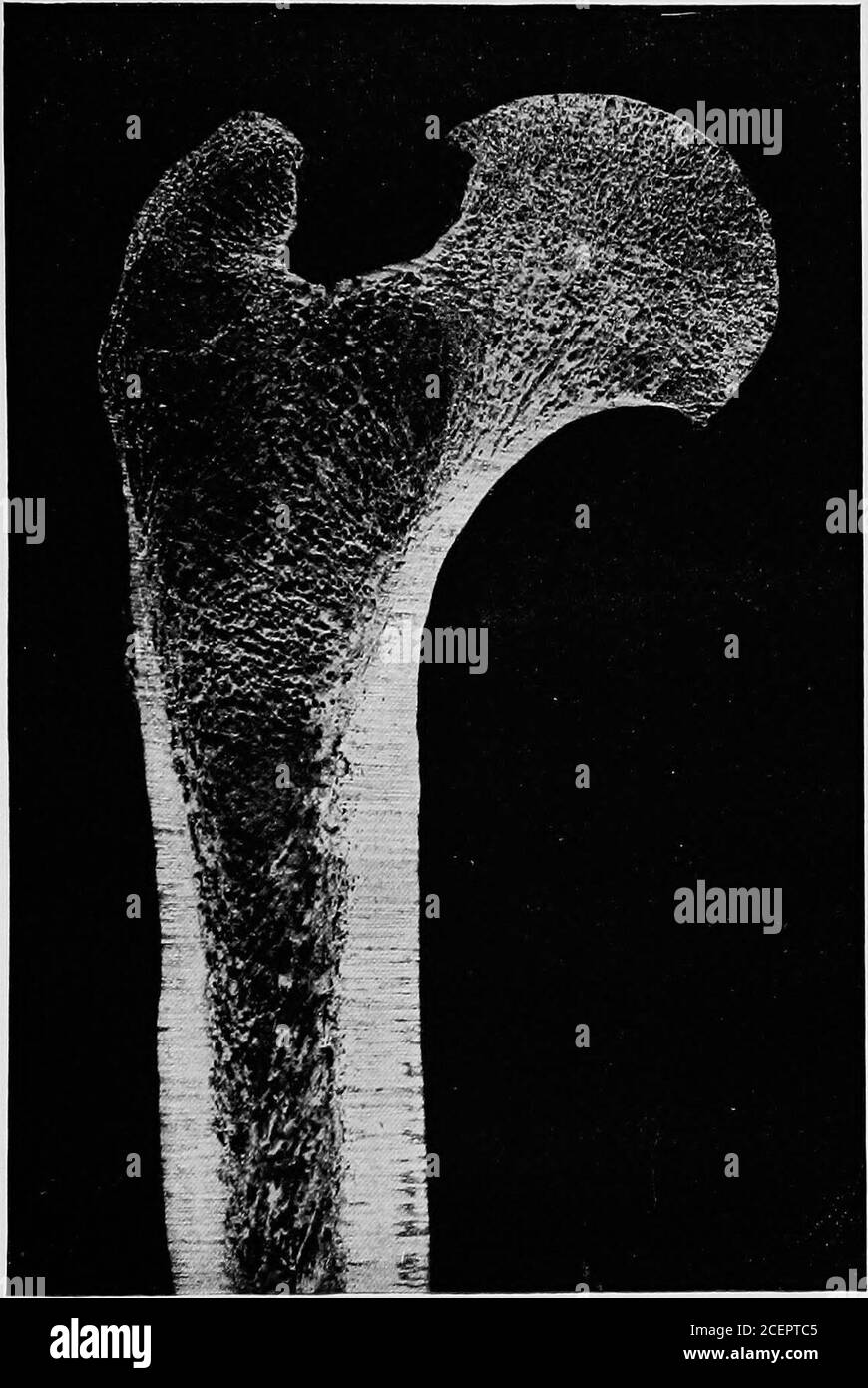 . On boneformation, its relation to tension and pressure;. Fig. 2. Fig ...
