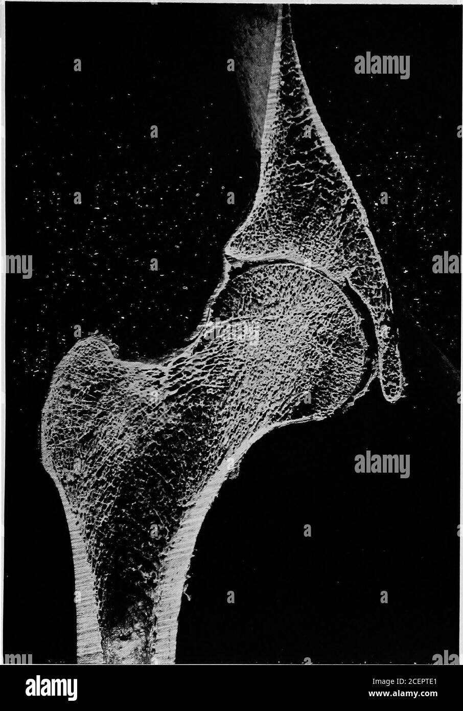 . On boneformation, its relation to tension and pressure;. body weight ...