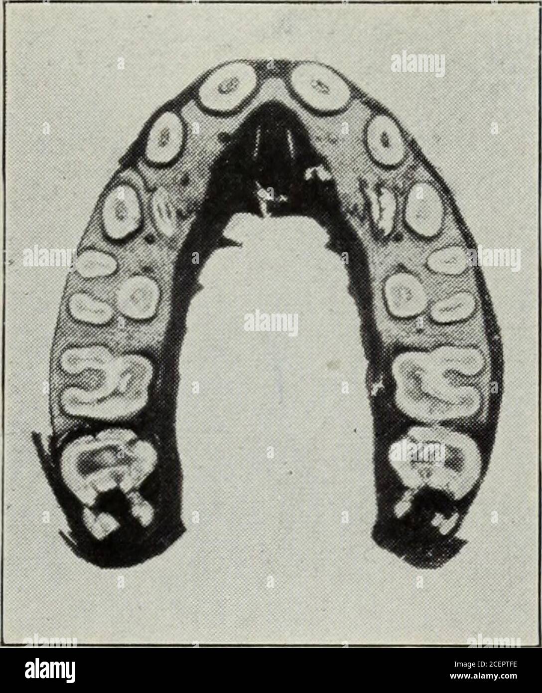 . The Dental cosmos. Fig. 12 is a similar section of a root inthe lower ...