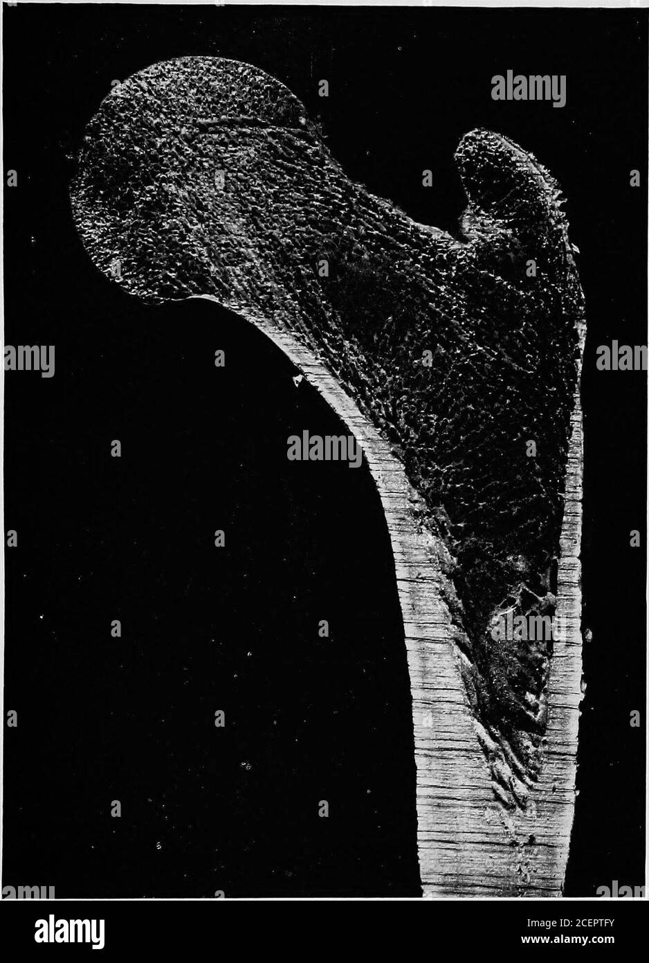 . On boneformation, its relation to tension and pressure;. Fig.. Fig. 2 ...