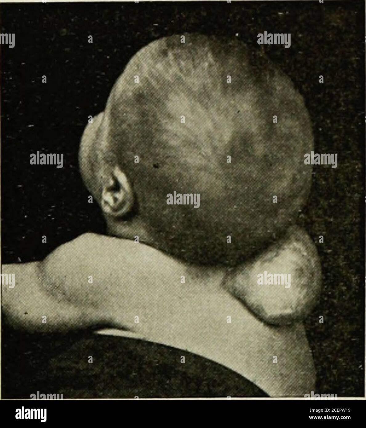 Patientshead hi-res stock photography and images - Alamy