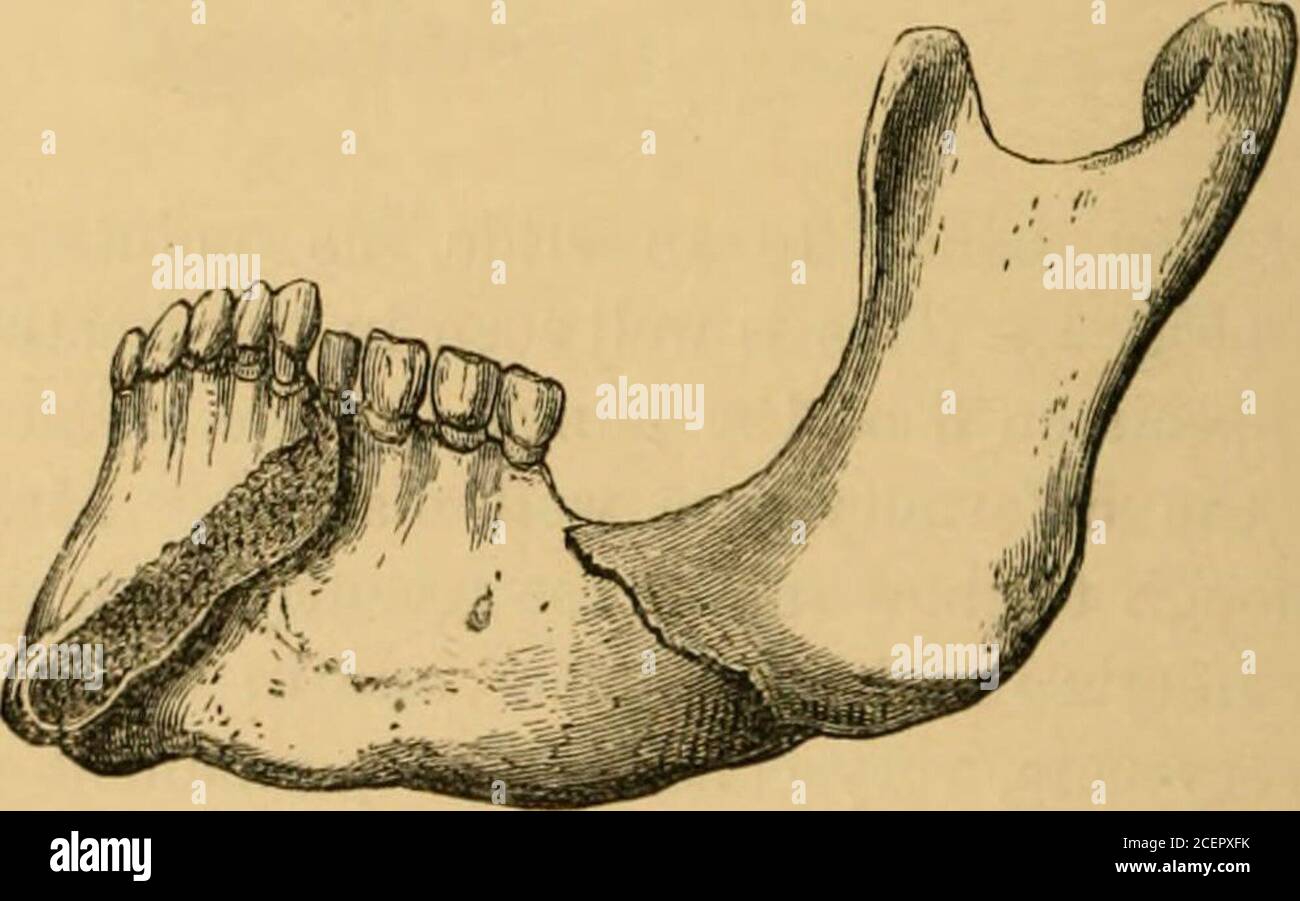 Large jaw muscles hi-res stock photography and images - Alamy